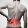 Low Back Pain - Paraspinals - West Suburban Pain Relief