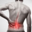 Low Back Pain - Paraspinals - West Suburban Pain Relief