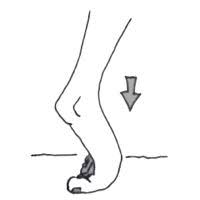 Hammer toes, foot pain? - Check out West Suburban Pain Relief!