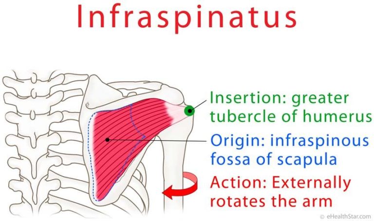 Infraspinatus Muscle - Shoulder to Hand Pain - West Suburban Pain Relief