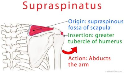 Supraspinatus Muscle - Arm Raising Pain - West Suburban Pain Relief