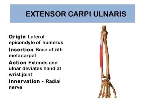 Wrist Extensors - Hand and Forearm Pain - West Suburban Pain Relief